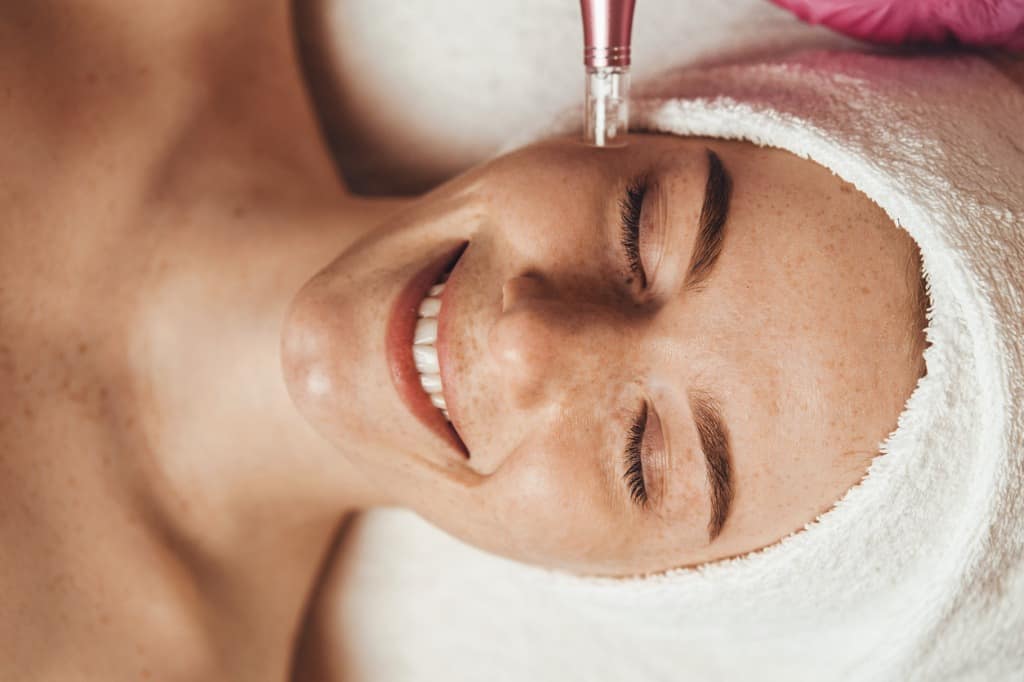 Unlock the Secret to Smooth, Youthful Skin with RF Microneedling ...